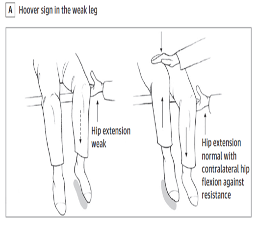 Bedside Rounds: Diagnosing Functional Neurological Disorders – Clinical ...